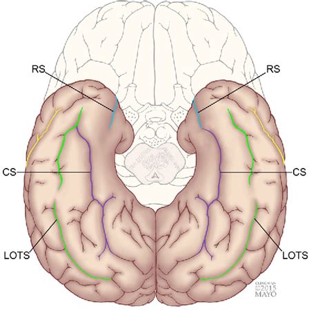 Occipitotemporal Sulcus Semantic Scholar
