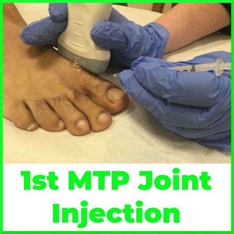 Performing An Ultrasound Guided First Mtp Joint Injection Sports Medicine Review R Orthopaedics