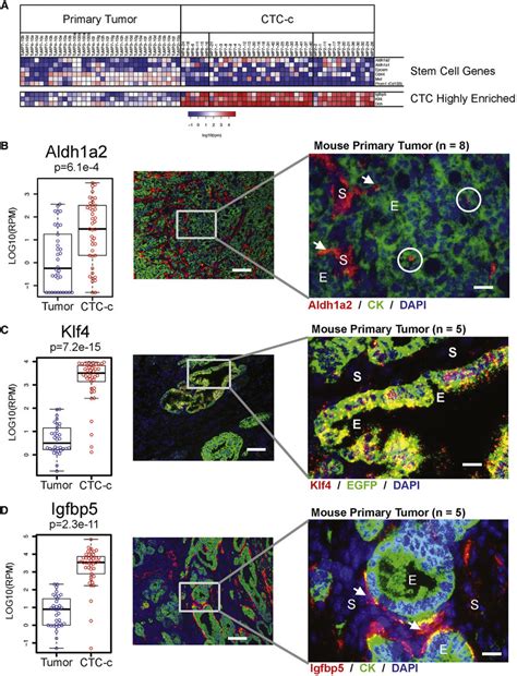 Ctc Enriched Genes Found In Epithelial And Stromal Components Of