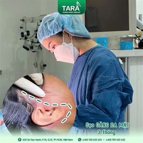 Timeline Hồi Phục Sau Phẫu Thuật Căng Da Mặt Taraclinic