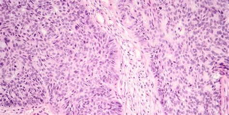 Understanding Inflammaging And Its Impact On Your Skin Sapelo Skin Care