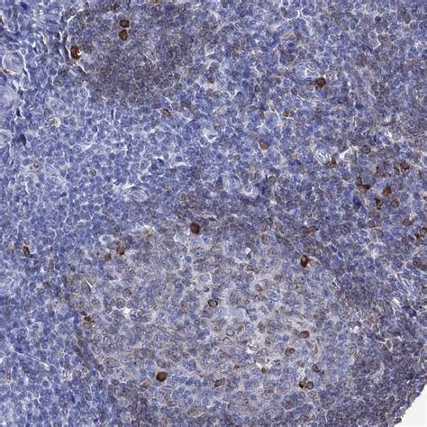 Rabbit Polyclonal Anti Cd79a Antibody Buy For Research Highly