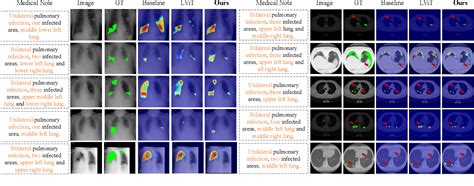 Figure 1 From Cross Modal Conditioned Reconstruction For Language Guided Medical Image
