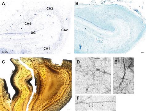 The Human Hippocampal Formation A Nissl Staining Seen Are The