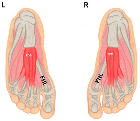 Flexor Digitorum Longus Tendon