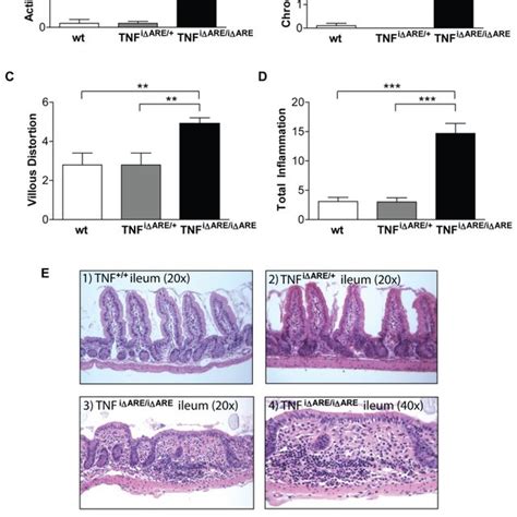 Histological Assessment Of Inflammation In The Terminal Ileum Was Done Download Scientific
