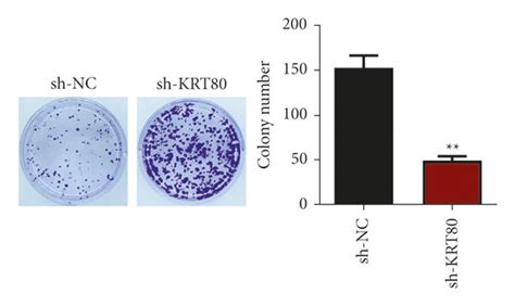 Repressing Krt80 Abrogated Nsclc Cell Proliferation In Vitro A And B Download Scientific