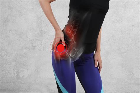 Hip Arthrogram With Anesthesia Su Spine And Sports Hip Arthrogram With Anesthesia Su Spine And Sports