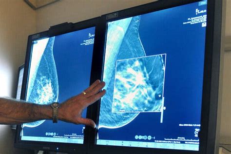 New Mammogram Advice What To Know The New York Times