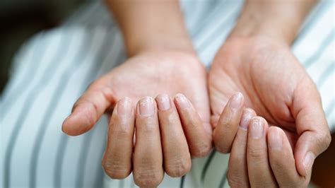 Can Ridges In Your Nails Signal Thyroid Disease An Md Reveals The
