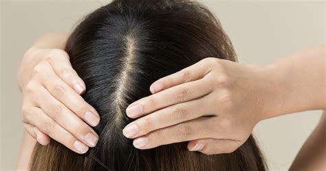 What You Need To Know About Formulating For Scalp Happi