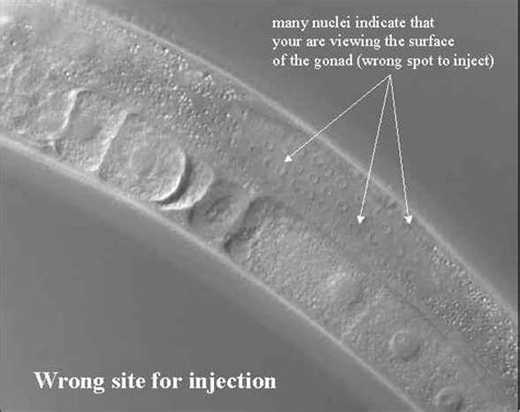 C Elegans Microinjection — The Open Lab Book V1 0