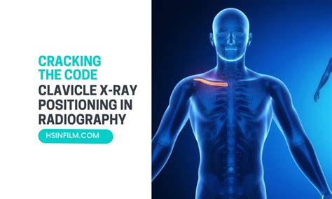 Clavicle X Ray Positioning In Radiography Cracking The Code Hsin Film