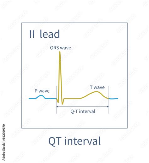 The Qt Interval Of Ecg Is From The Beginning Of Qrs Wave To The End Of T Wave Representing The