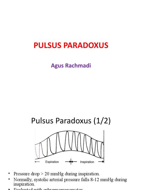 Pulsus Paradoxus Pdf