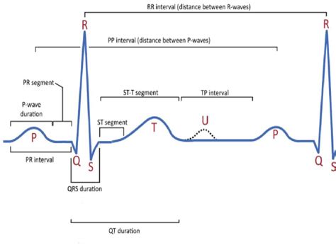 Figure 1 From A Review On Heartbeat Classification For Arrhythmia