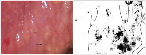 Sandy Patches Appearing As Grains And Homogenous Yellow Areas Of The Download Scientific
