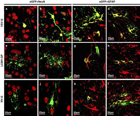 Double Immunohistochemical Staining Of Representative Brain Sections