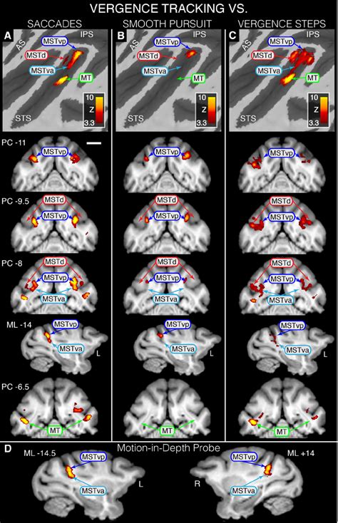 Statistical Maps Overlaid On Flattened Left Cortical Surfaces Top Row Download Scientific