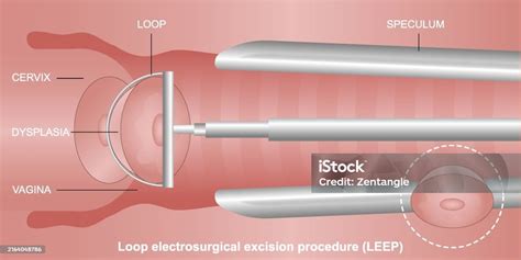 A Leep Stock Illustration Download Image Now Adult Anatomy