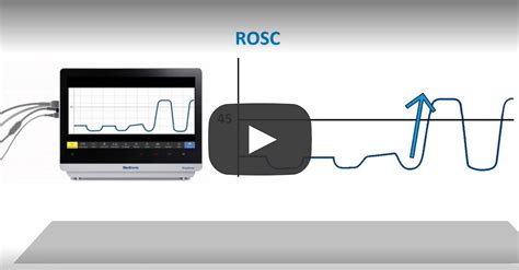 Capnography Waveform For Cardiorespiratory Arrest David Sedlacek Posted On The Topic Linkedin