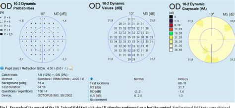 Figure 1 From Discrimination Ability Of Central Visual Field Testing Using Stimulus Size I Ii