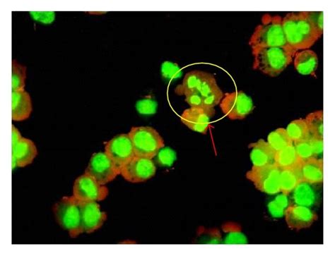 Determination Of Apoptotic Cells By Acridine Orange Staining Of A549