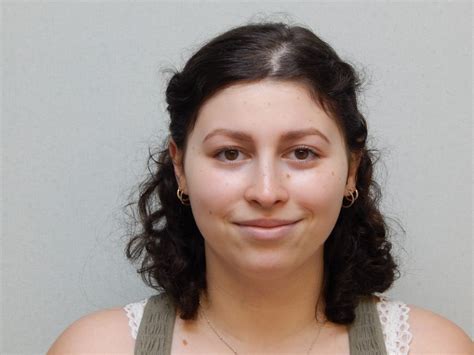 Rhinoplasty Gallery Template 2 Format Draft 2 Plastic Surgery Professionals