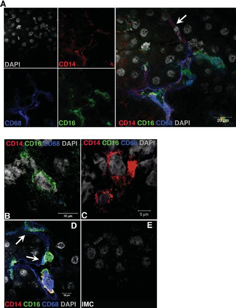 Monocyte Subset Localization In Human Liver Tissue The Localization Of