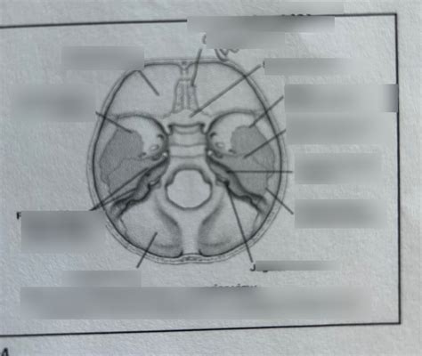 Temporal Bones Superior View Diagram Quizlet