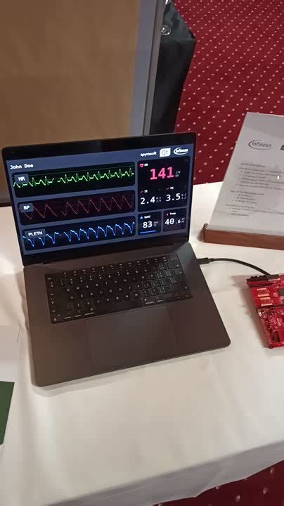 Przemysław Krzywania On Linkedin Automotive Microcontrollers