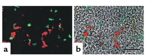 Adoptive Transfer Of Cd4 Lymph Node Cells From Disease Affected H3