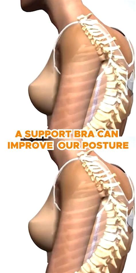 Posture Correcting Bra Artofit