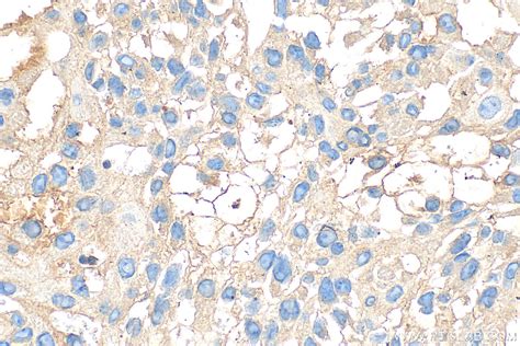 Egfr Antibody 30847 1 Ap Proteintech