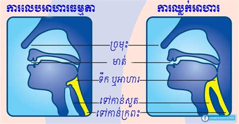 ដើម្បីសុខភាព ស្វែងយល់ អំពី «វិបត្តិនៃការហូបអាហារលើអ្នកជំងឺស្ទះ ឬដាច់សរសៃឈាមខួរក្បាល នគរដ្រេហ្គន