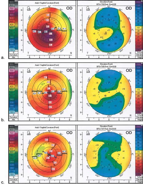 Optical Analysis Plos One