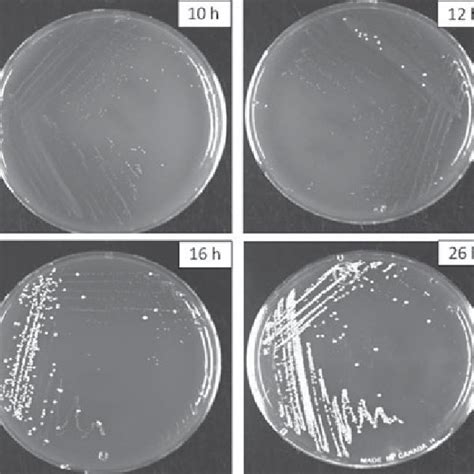 Pdf Staphylococcus Aureus Small Colony Variants Scvs And Their Role In Disease
