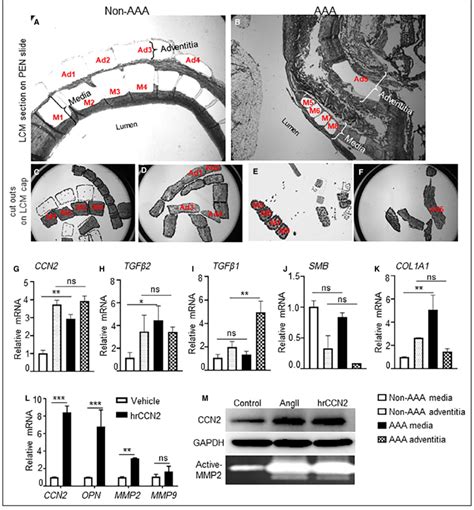 increased ccn2 cellular communication network factor 2 expression in