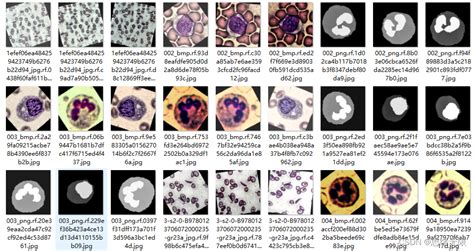 血细胞智能检测与计数软件（pythonyolov5深度学习模型清新界面版）细胞计数 Python Csdn博客