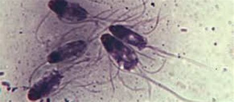 Hexamita - Koi Oasen