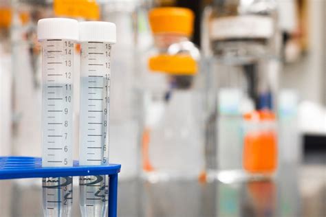 Ca 125 Tumor Marker Jajnika Millenium Medic Laboratorija I Poliklinika