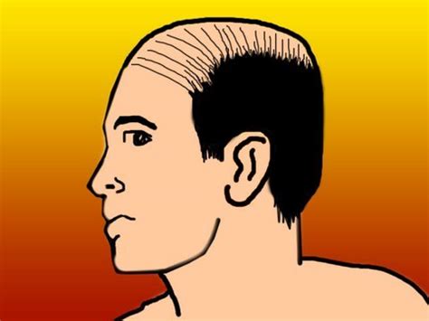 Do Bald Men Have More Sex Drive Sex Health Guru YouTube