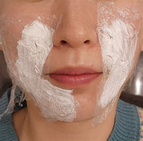 안산 팔자주름 필러 찐 후기 필러 주의사항 네이버 블로그
