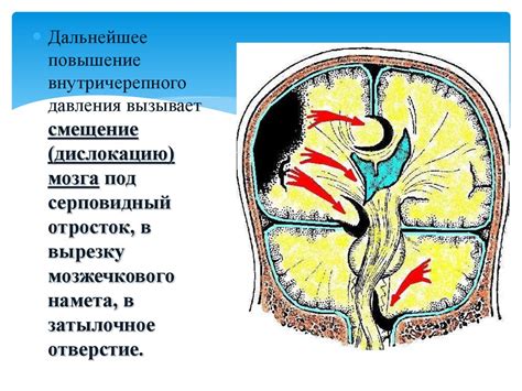 Черепно–мозговая травма - online presentation