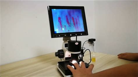 Capillary Microcirculation Microscope Youtube