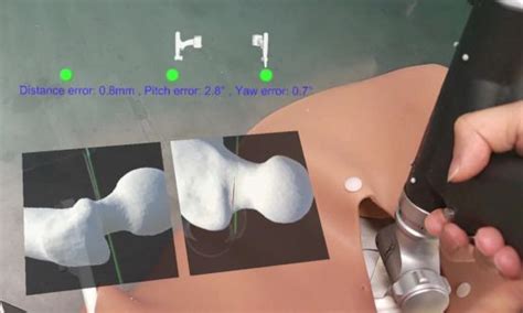 Surgicalproficiency Innovation Healthcare Ar Orthopedics