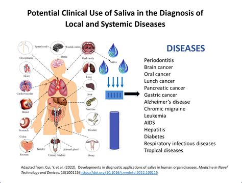 Could Saliva Become The Go To Diagnostic Specimen For Infectious