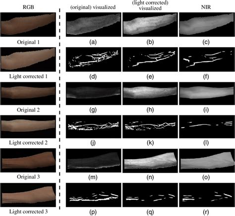 Vein Visualization Results Before And After Light Correction A The