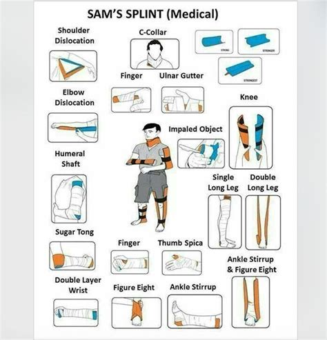 Rescue Essentials On Linkedin Did You Know That Sam Splints Dont Need To Be Removed For X Rays