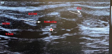 Journal Of Minimal Access Surgery